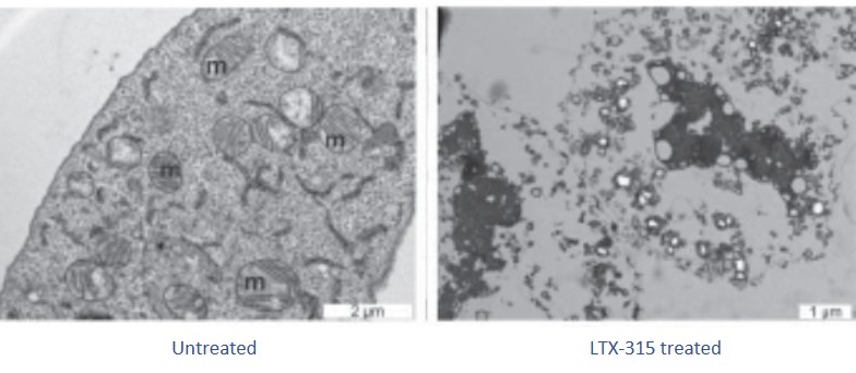 Technology - Lytix Biopharma